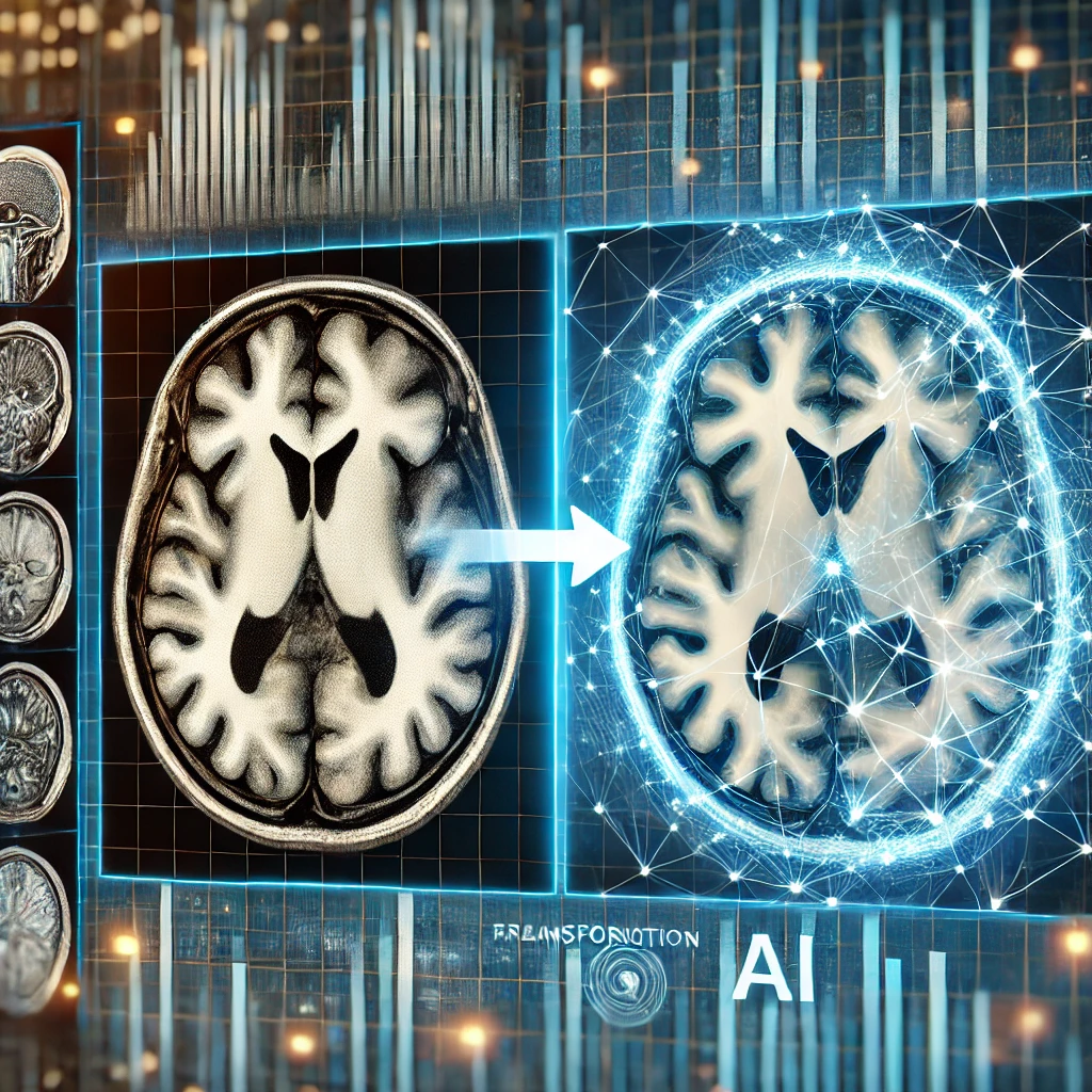 SIEMENS Deep Resolveとは？MRI AI再構成を解説｜放射線技師のMRIメモ